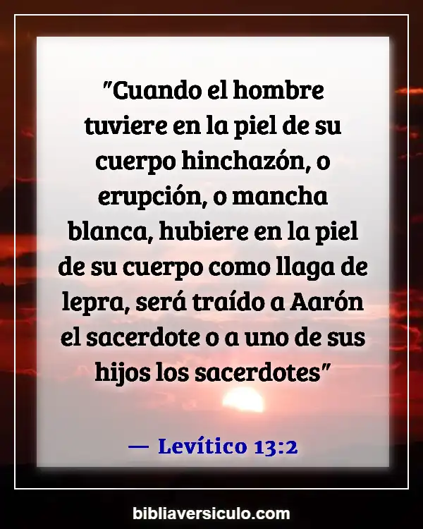 72+ Versículos De La Biblia Sobre Leprosos